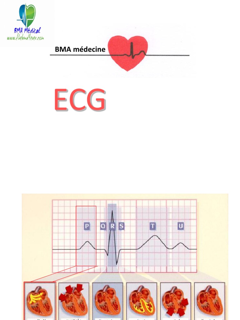 Analyse et Interprétation de l'ECG | PDF | Technologie et ingénierie