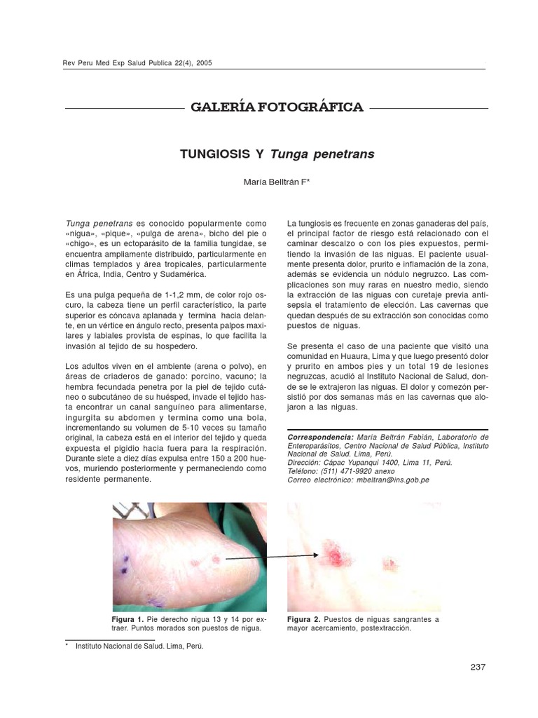 Tunga Penetrans | PDF | Salud y bienestar | Medicina