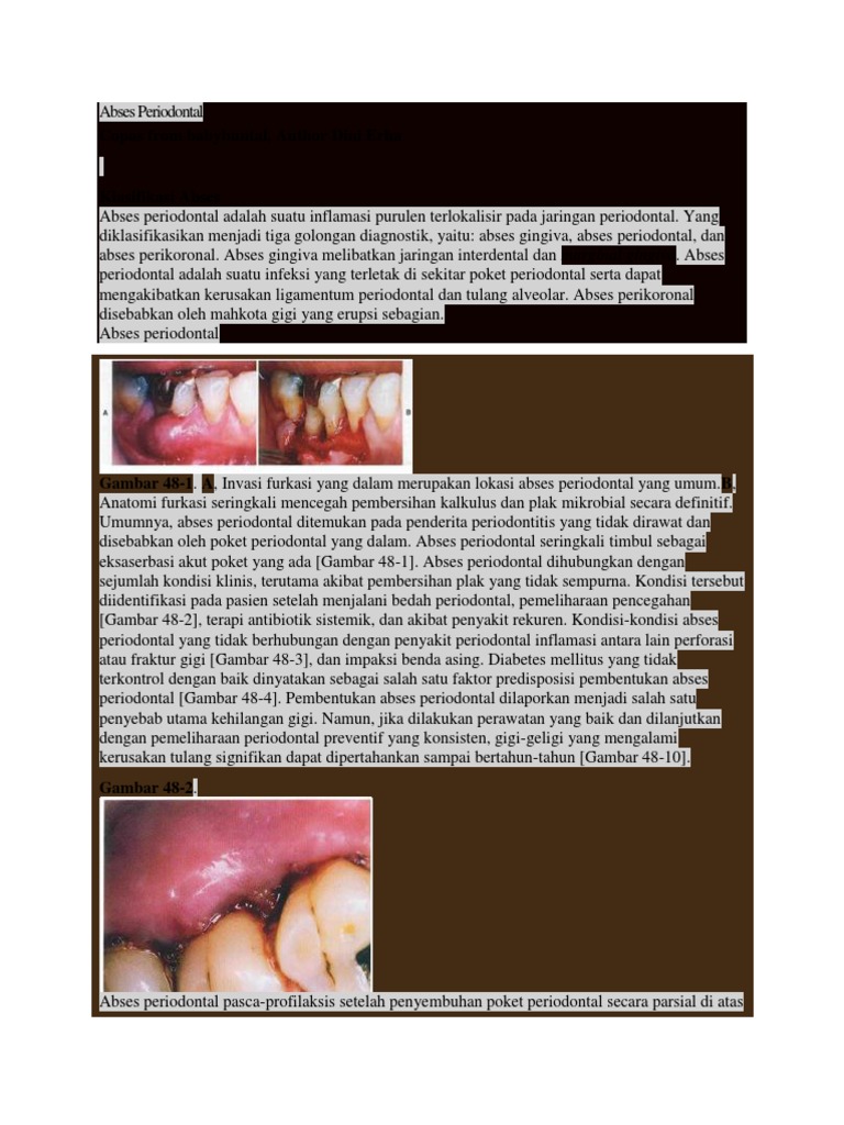 Abses Periodontal | PDF