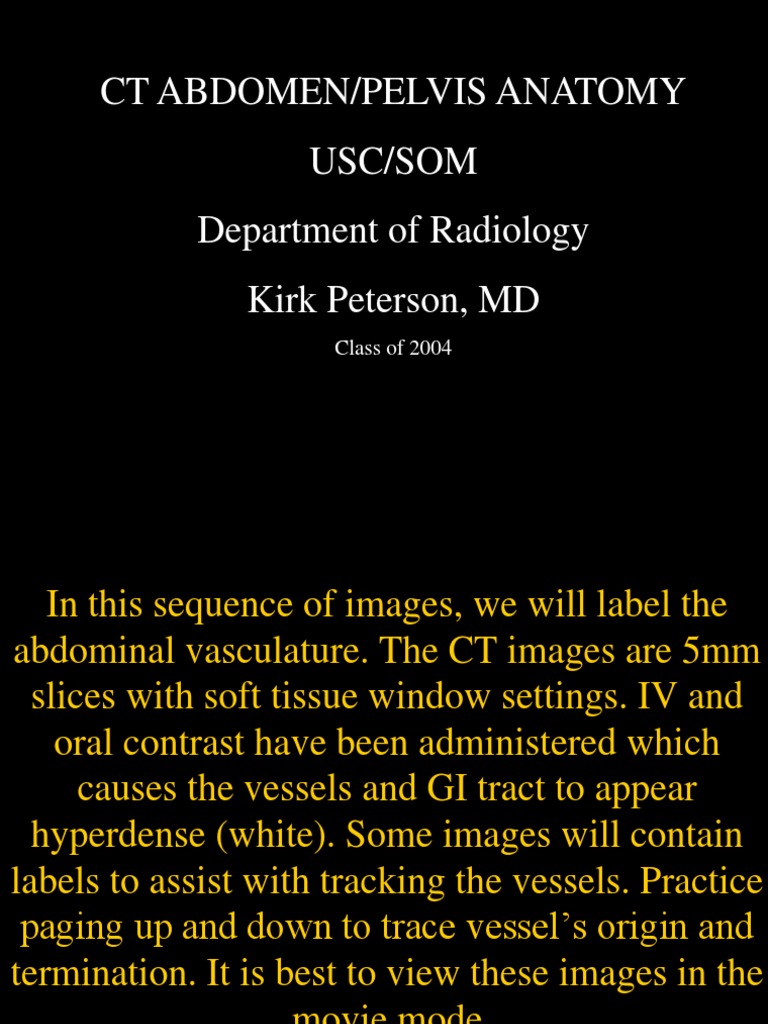 CT Abdomen/Pelvis Anatomy Usc/Som Department of Radiology Kirk Peterson ...