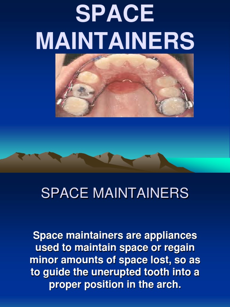 Space Maintenance | PDF | Tooth | Mouth