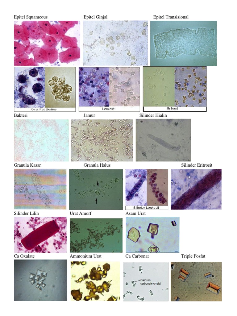Sedimen Urine | PDF