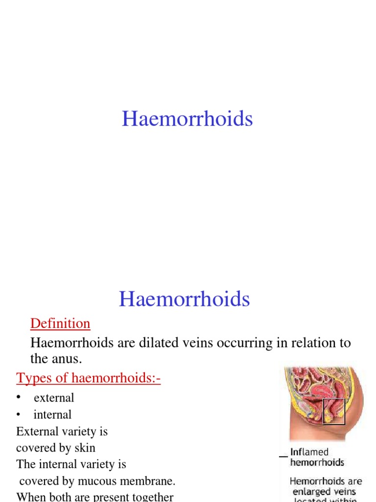 Haemorrhoids | PDF