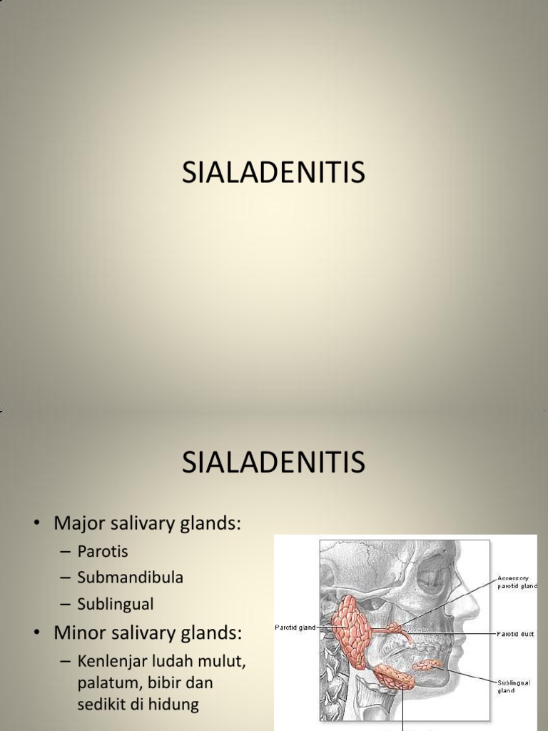 Sialadenitis | PDF