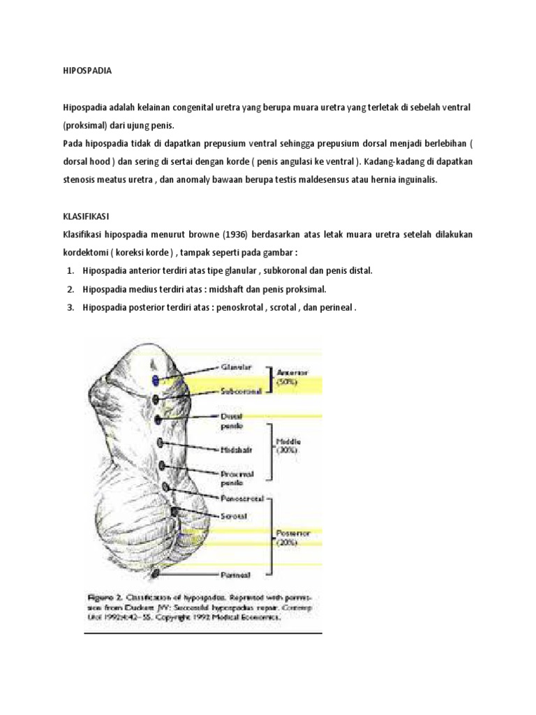HIPOSPADIA | PDF