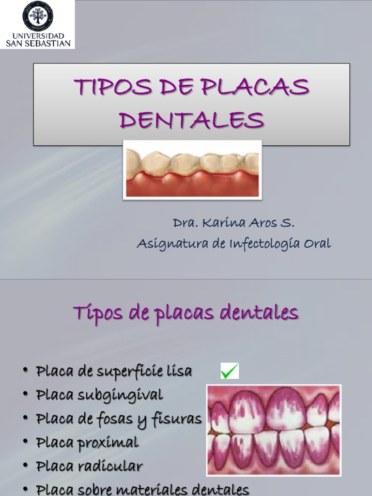 Clase 3 Tipos de Placas Dentales | PDF | Diente humano | Las bacterias