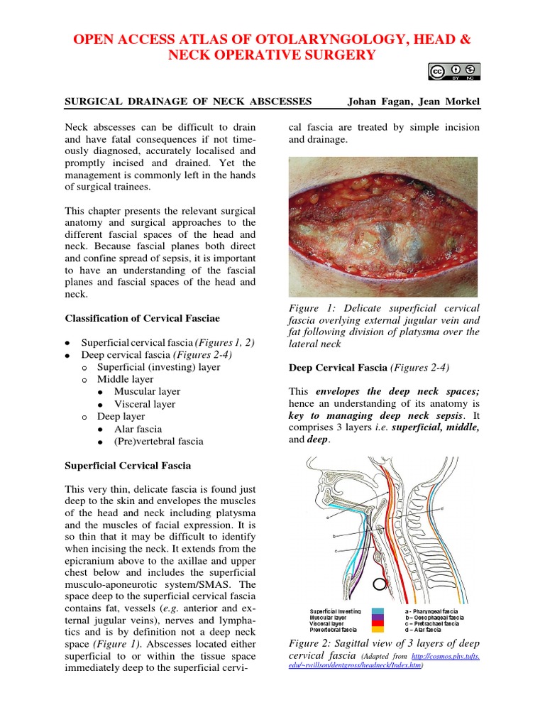 Surgical Drainage of Deep Neck Abscesses | PDF | Common Carotid Artery ...