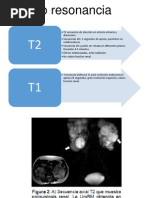 Pielotac y Urotac: Diagnóstico Urinario Avanzado | PDF | Ct Scan ...