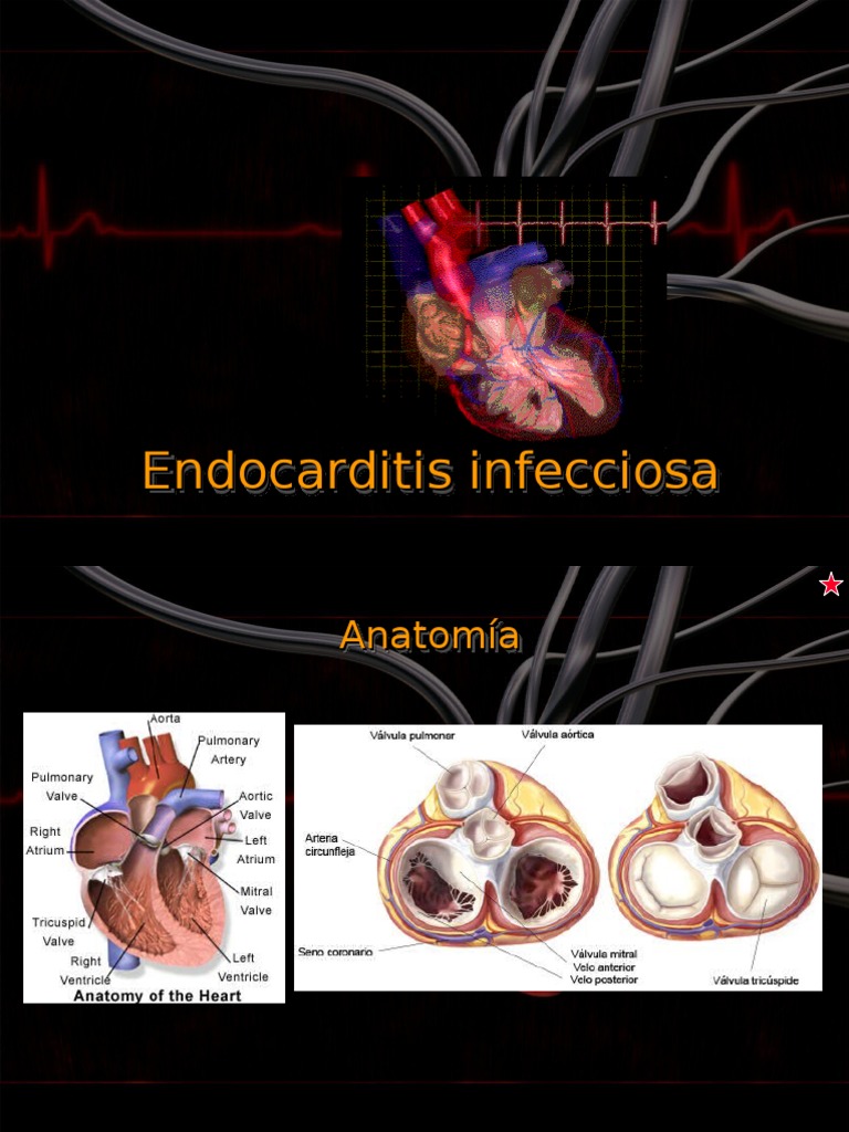 Endocarditis infecciosa | Corazón | Medicina CLINICA