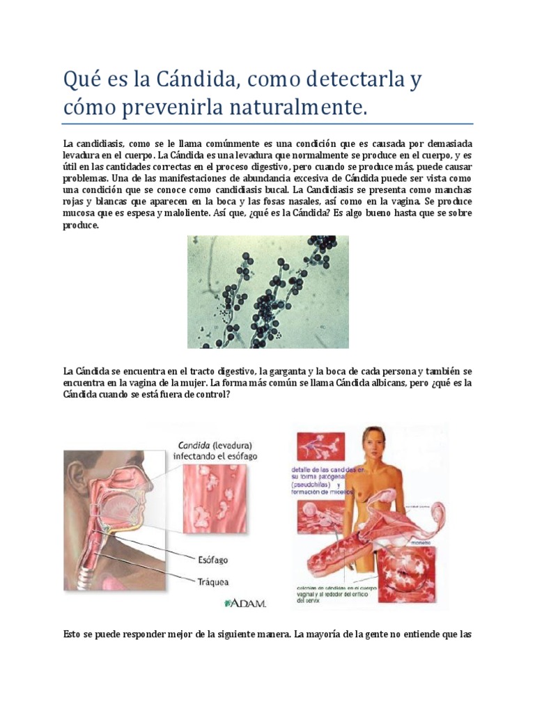Qué Es La Cándida, Como Detectarla y Prevenirla Naturalmente | PDF ...