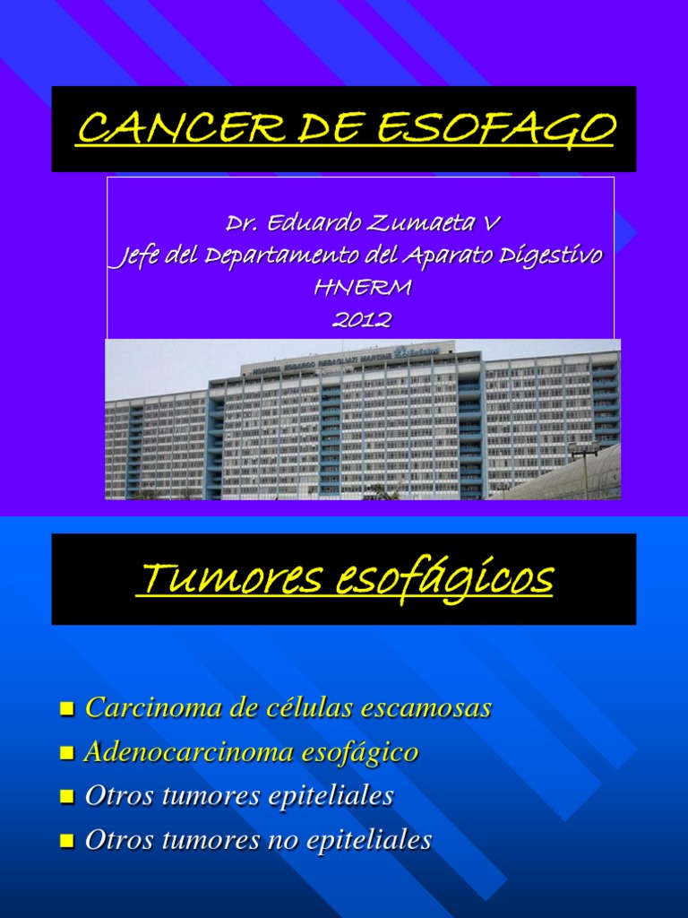 Cancer de Esofago | PDF | Cáncer de esófago | Metástasis