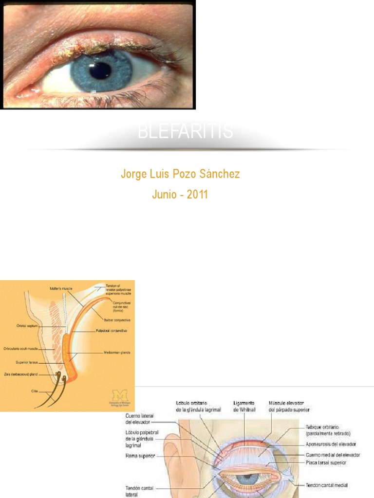 Blefaritis | PDF | Especialidades Medicas | Enfermedades y trastornos