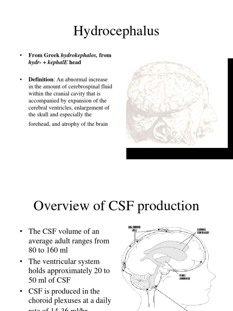 Hydrocephalus.ppt | Cerebrospinal Fluid | Neurological Disorders