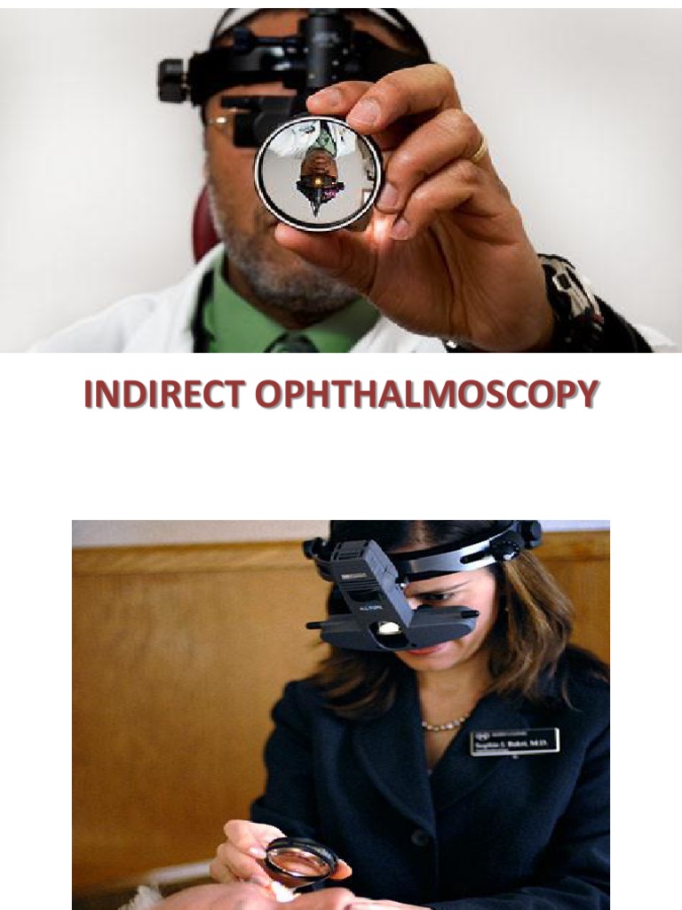 Indirect Ophthalmos | PDF | Retina | Lens (Optics)