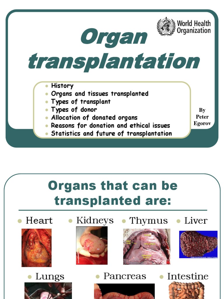 Ethics in Organ Transplantation | PDF | Organ Transplantation | Organ ...