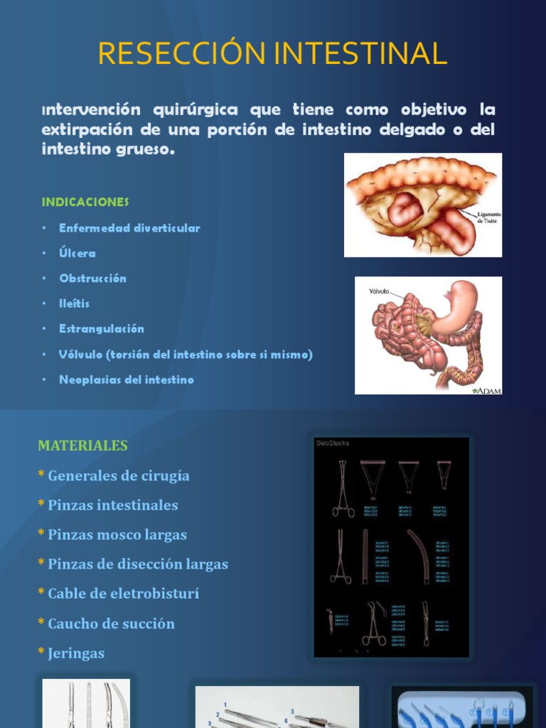 Resección Intestinal | PDF