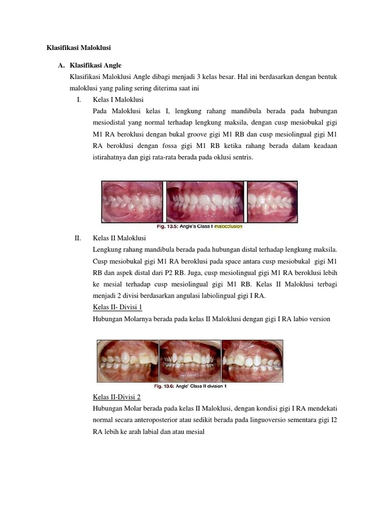 Klasifikasi Maloklusi Angle dan Dewey | PDF