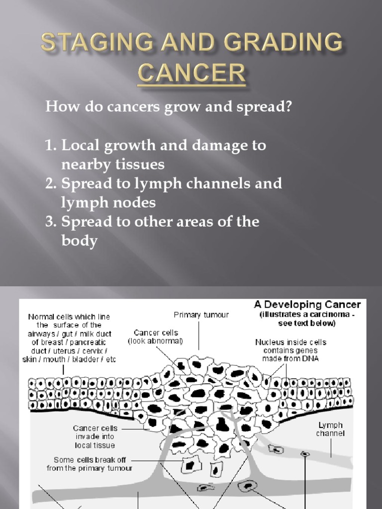 Staging and Grading Cancer | PDF