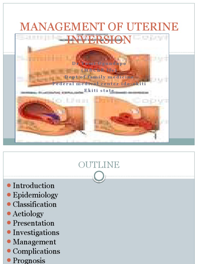 Management of Uterine Inversion | PDF | Uterus | Childbirth