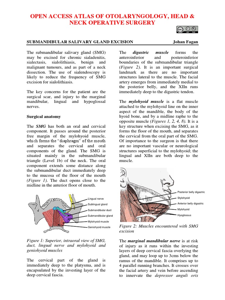 Submandibular Gland Excision | PDF