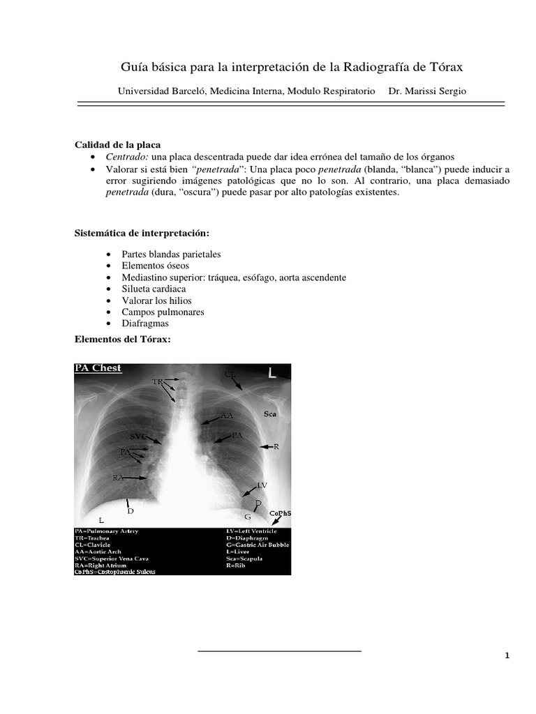 Guía Básica para La Interpretación de La Radiografía de Tóraxx PDF | PDF | Pulmón | Tórax ...
