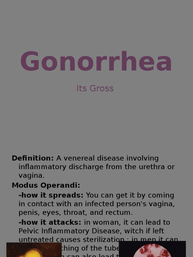 Gonorrhea: Its Gross | PDF | Science & Mathematics