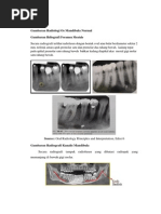 Interpretasi Hasil Foto Rontgen Anatomi Normal | PDF