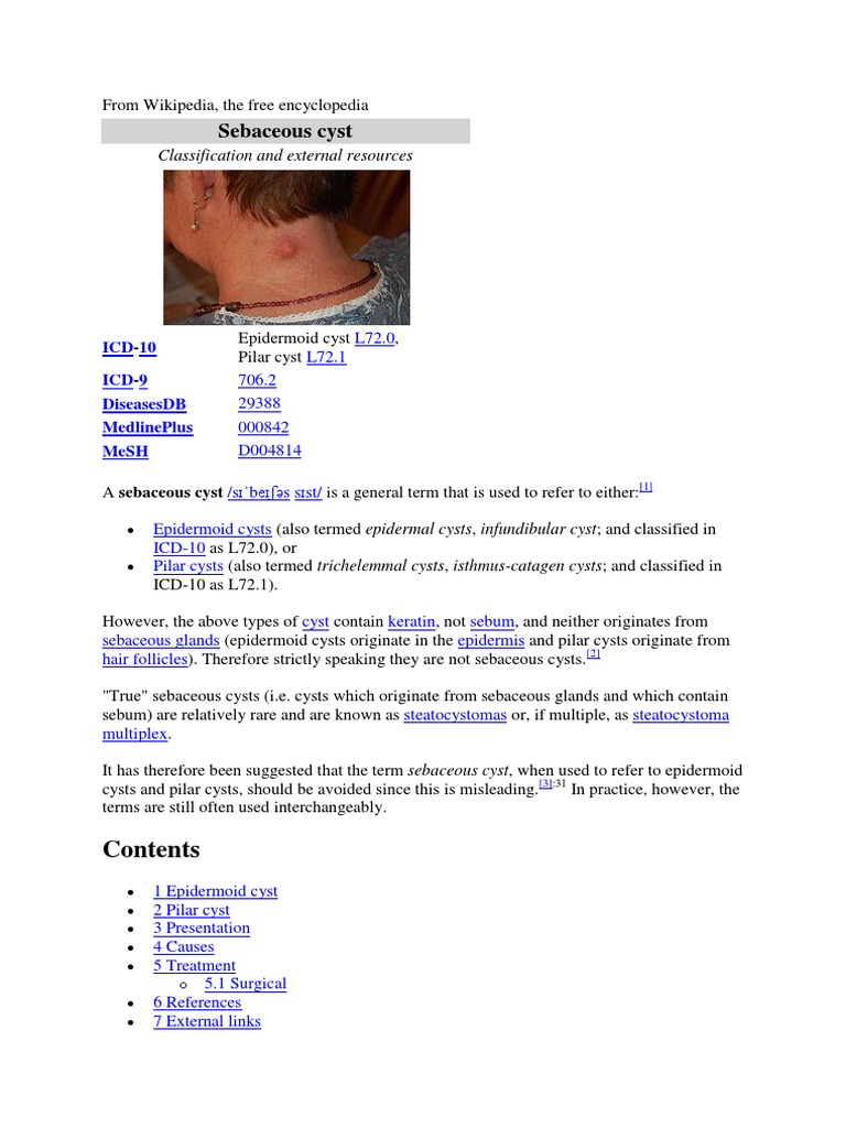 Sebaceous Cyst | PDF | Cutaneous Conditions | Medicine Sebaceous Cyst | PDF | Cutaneous Conditions | Medicine
