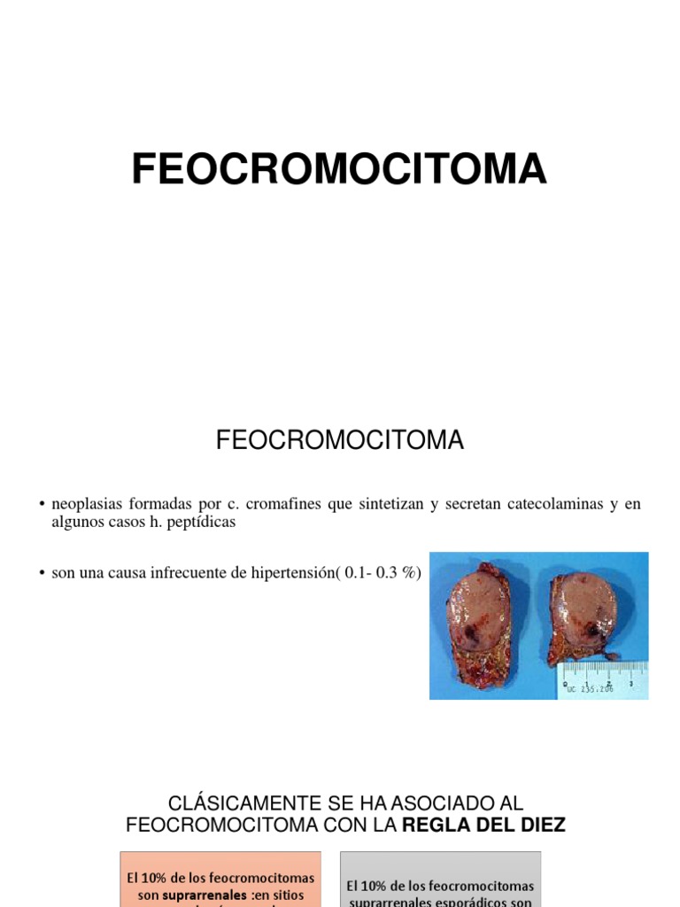 FEOCROMOCITOMA | PDF | Glándula suprarrenal | Cáncer