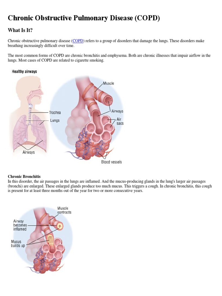 COPD Treatment, Diagnose | PDF | Chronic Obstructive Pulmonary Disease ...