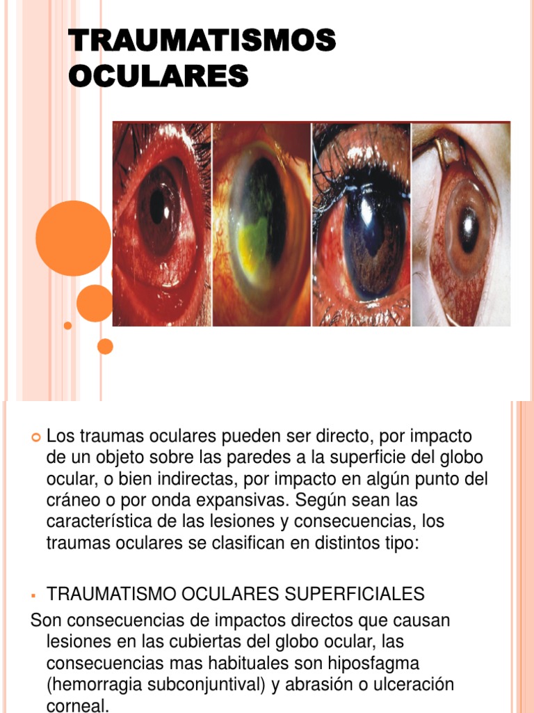 Tipos y Tratamiento de Traumatismos Oculares | PDF | Lesión | Ojo humano