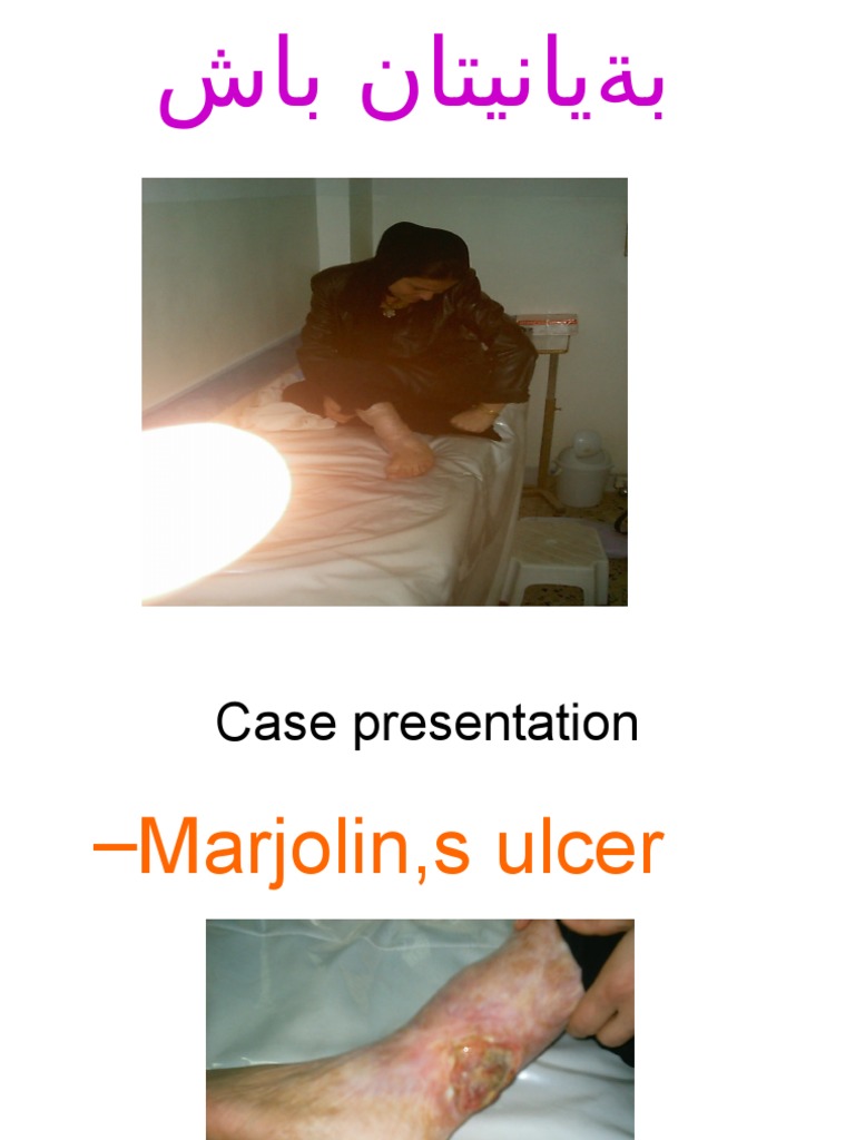Marjolins Ulcer | PDF | Carcinoma | Epidemiology