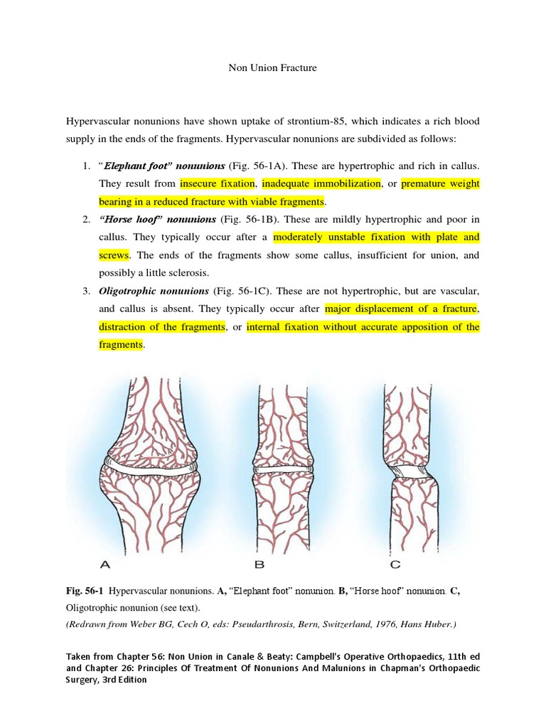 Hypertropic and Atrophic Non-Union | PDF | Skeletal System | Diseases ...
