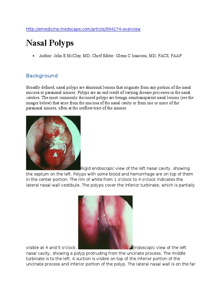 Nasal Polip | PDF | Allergy | Human Head And Neck