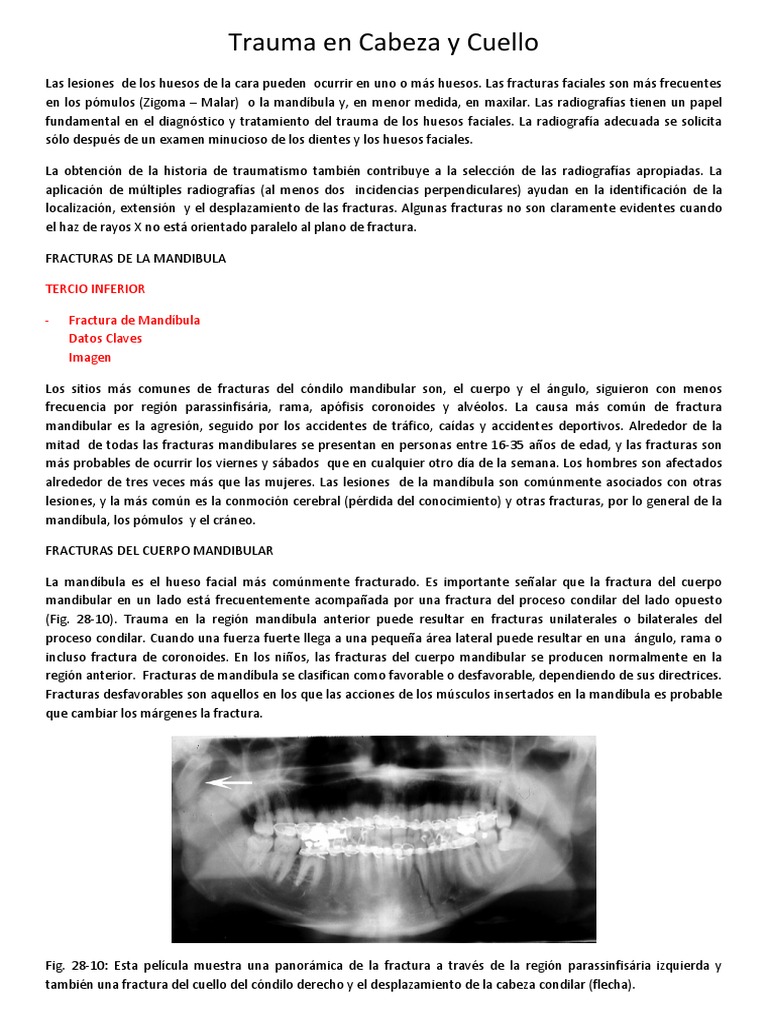 Trauma en Cabeza y Cuello | PDF | Lesión | Especialidades Medicas