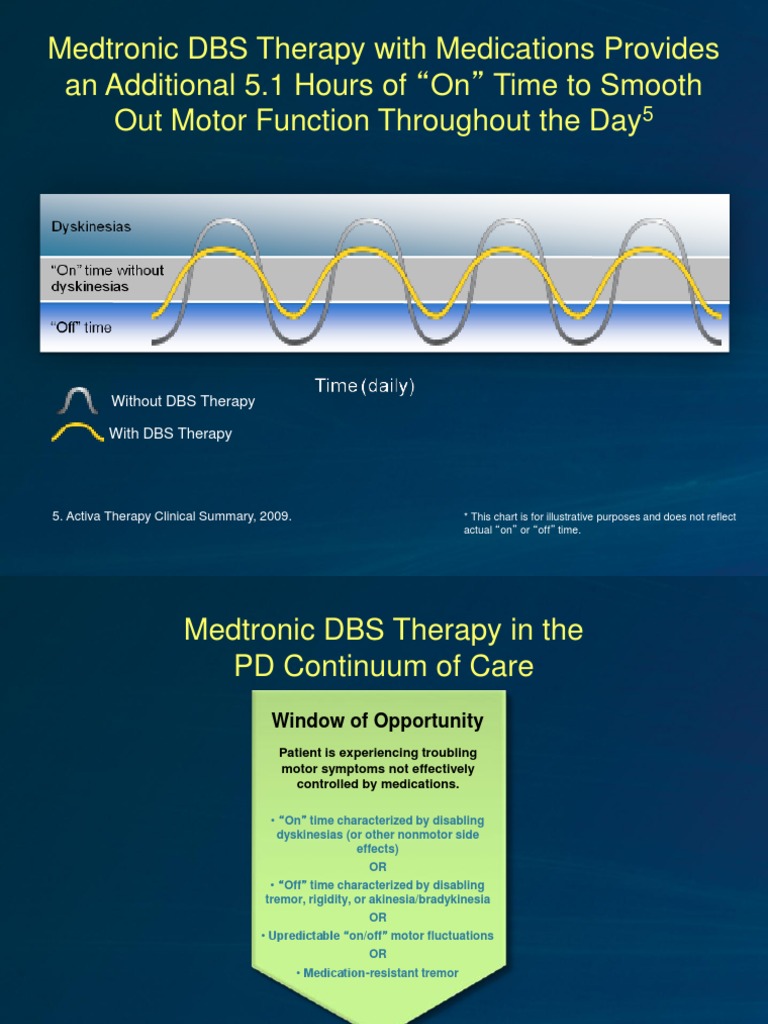 Dbs PD Presentation | PDF