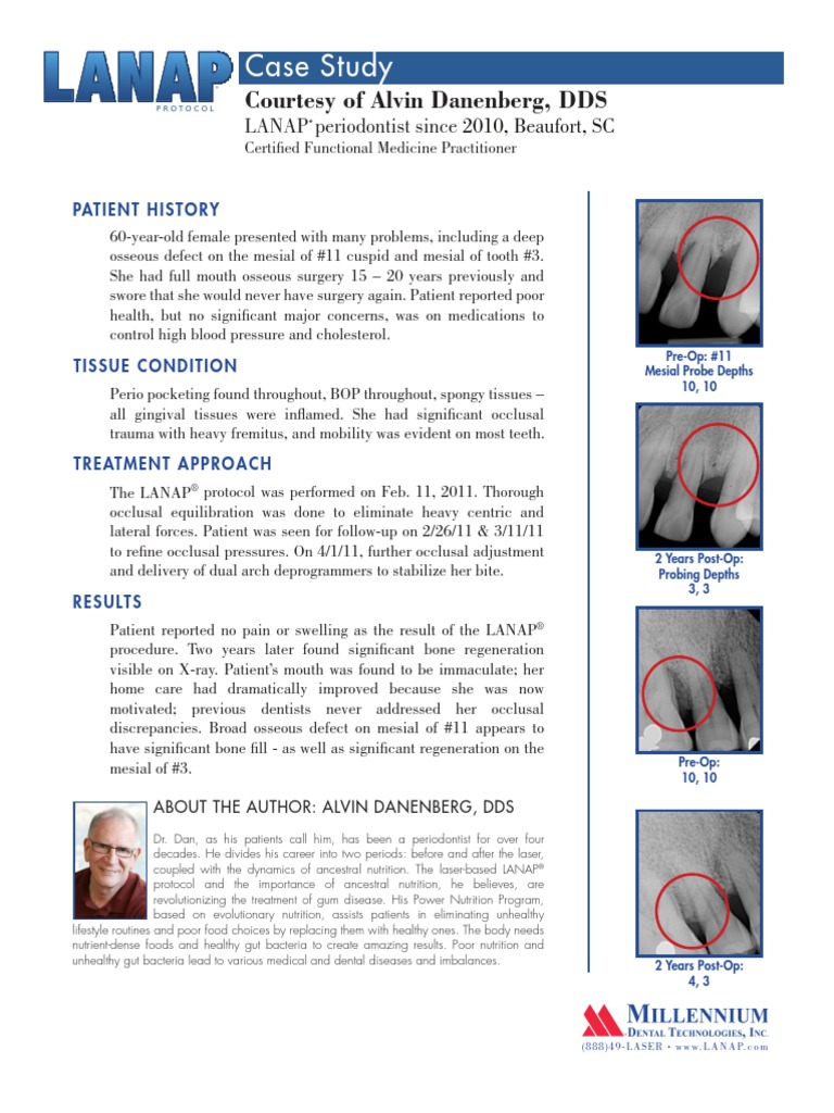 LANAP Danenberg Case Study | PDF | Clinical Medicine | Medical Specialties