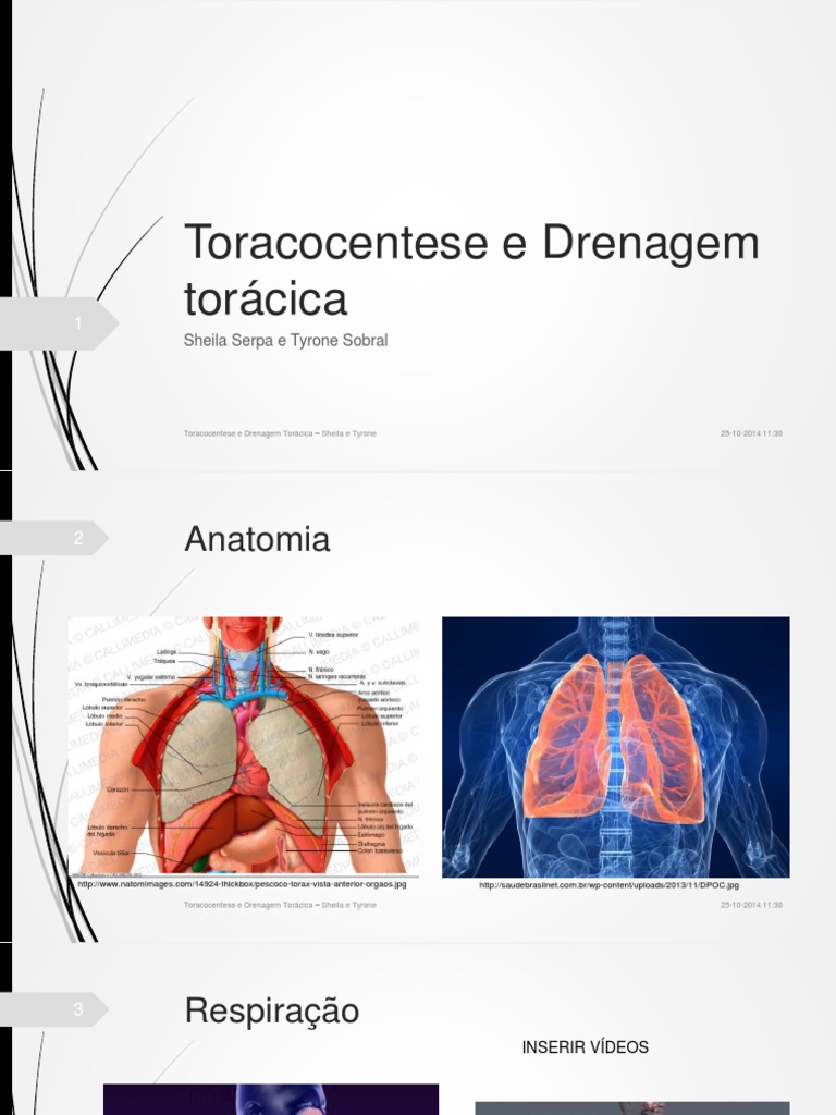 Toracocentese e Drenagem torácica COMPARTILHADO NO FACE.pdf ...