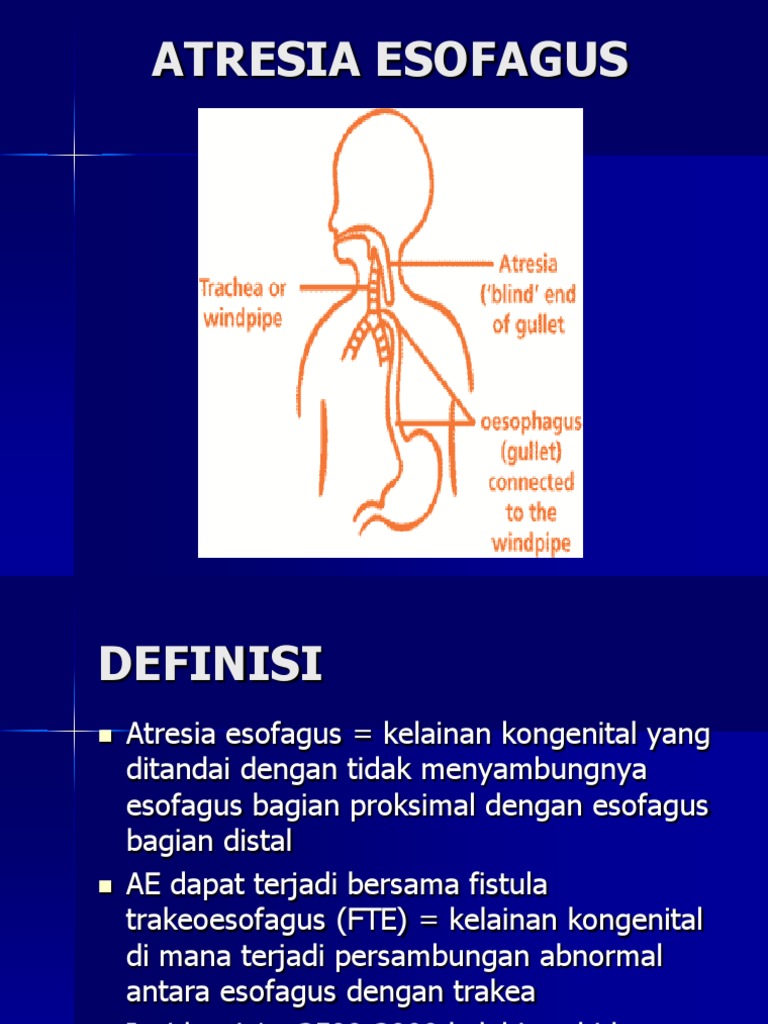 Atresia Esofagus | PDF | Kajian Bahasa Asing | Sains & Matematika