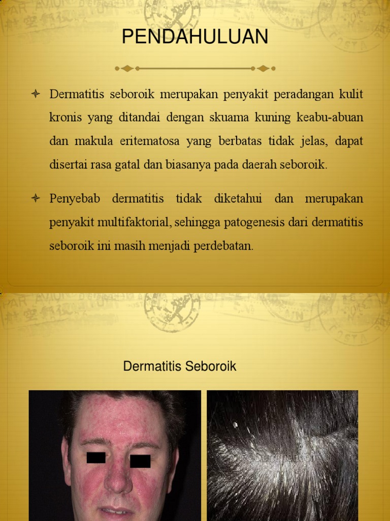 Dermatitis Seboroik: Panduan Lengkap | PDF | Sains & Matematika
