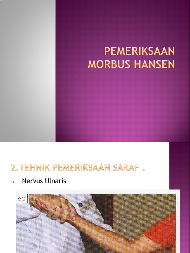 Pemeriksaan Morbus Hansen | PDF