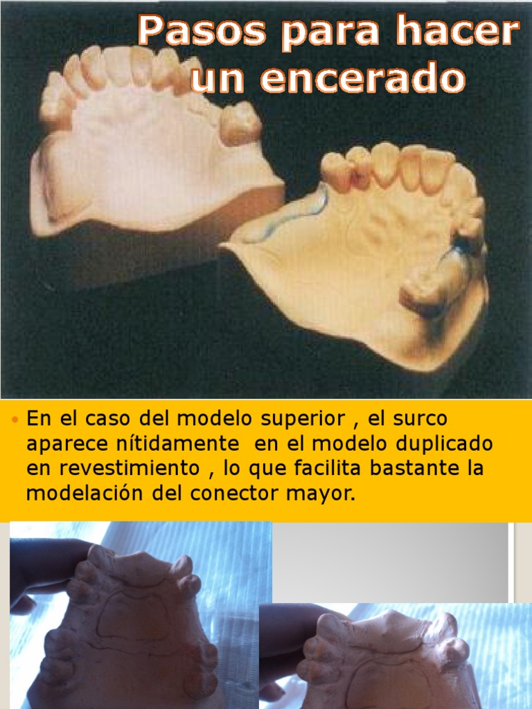 Pasos para El Encerado y Los PKT