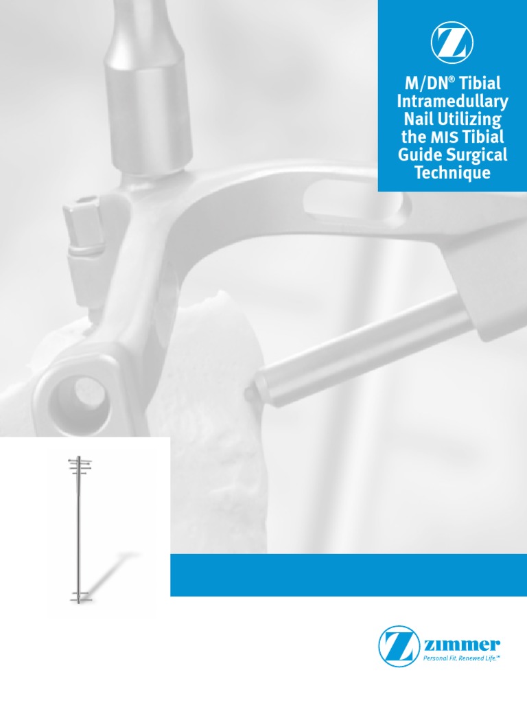 MDN Tibial Intramedullary Nail Utilizing The MIS Tibial Guide Surgical ...