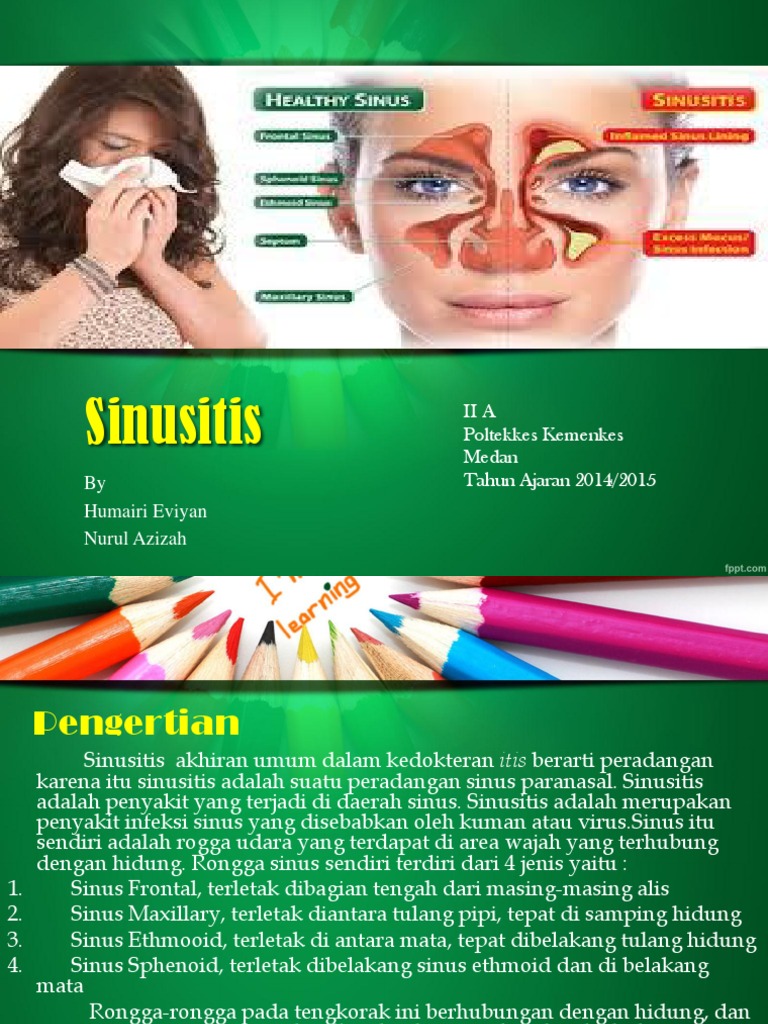 Sinusitis | PDF