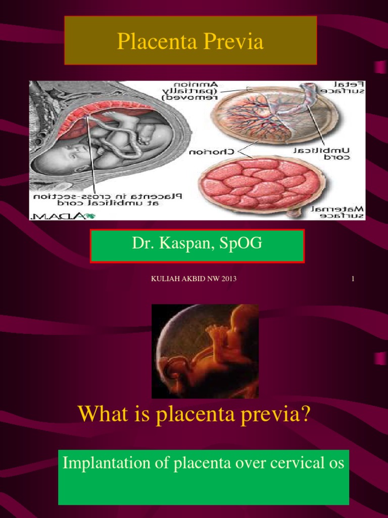 Plasenta Previa 2 | Placenta | Health Sciences