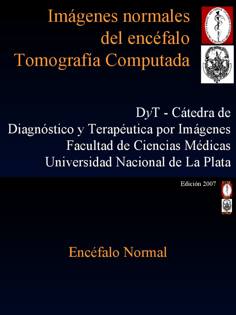 Encéfalo Normal TC | PDF | Cerebelo | Cerebro