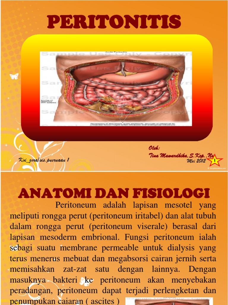 Pp Peritonitis.ppt