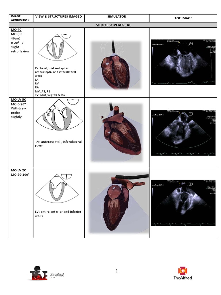 TOE Standard Views Expanded 21 Jan 2014 Small | PDF | Thorax (Human ...