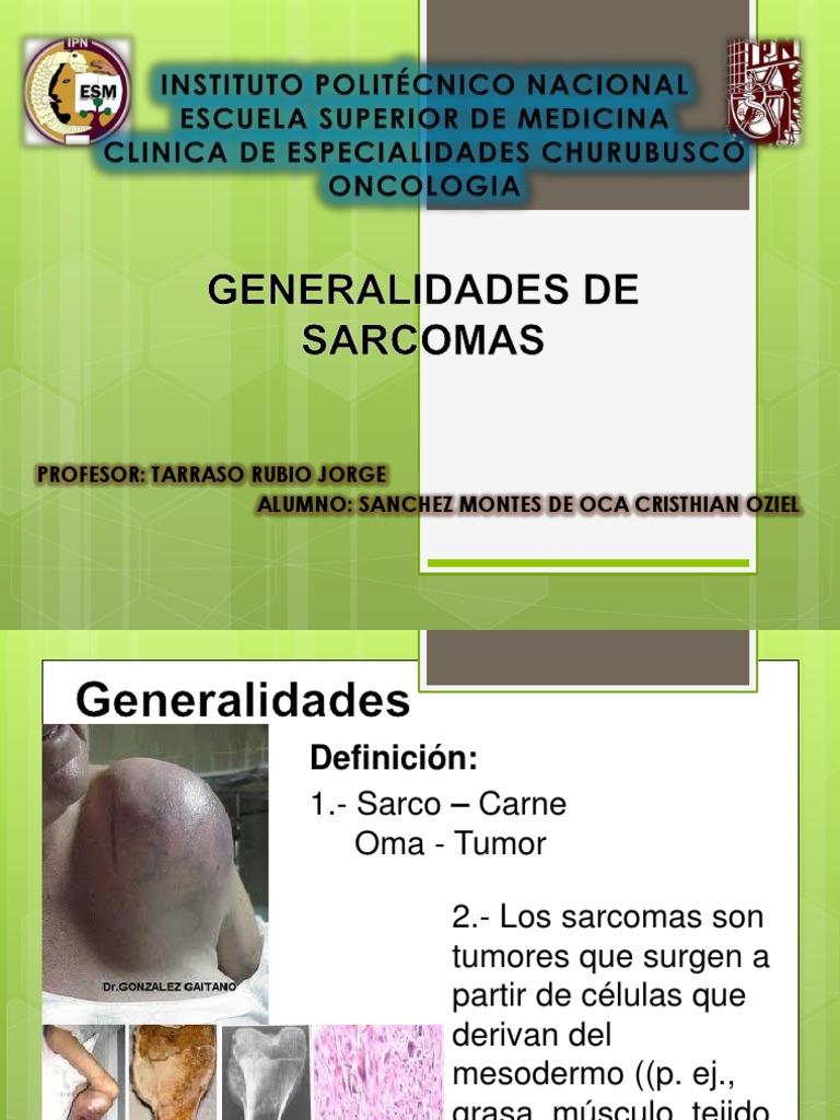 Sarcomas Onco | PDF | Sarcoma | Hueso