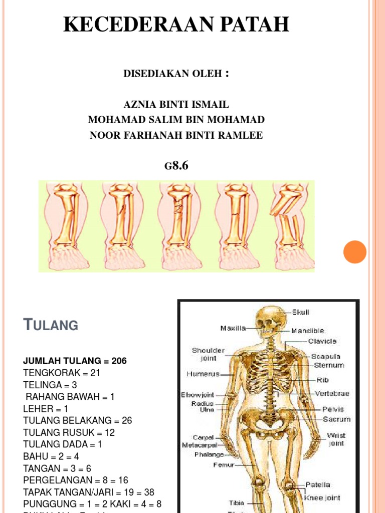 Jenis dan Rawatan Patah Tulang | PDF